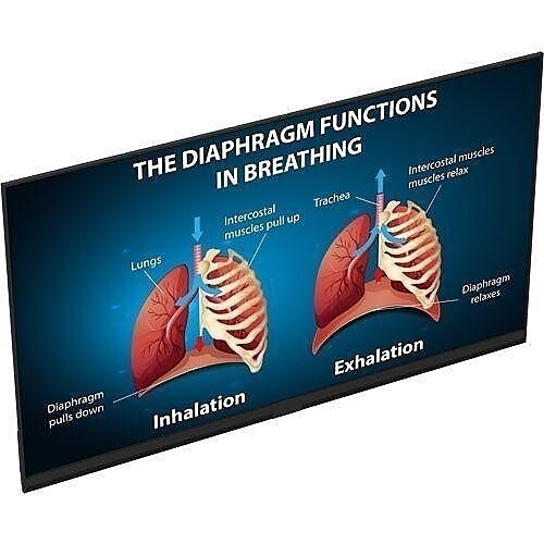 Image of 998-3773-00